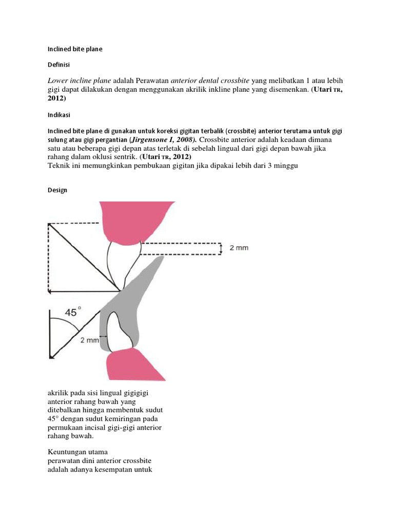 Inclined Bite Plane | PDF