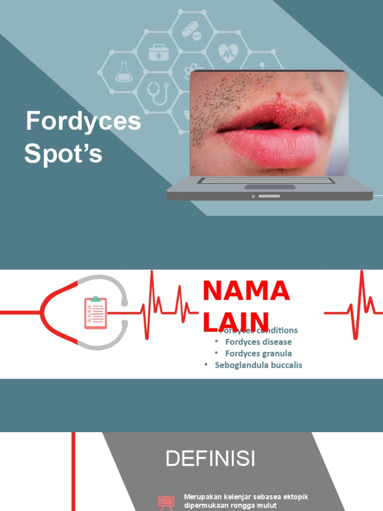 Fordyce Spots: Definisi dan Penanganan | PDF