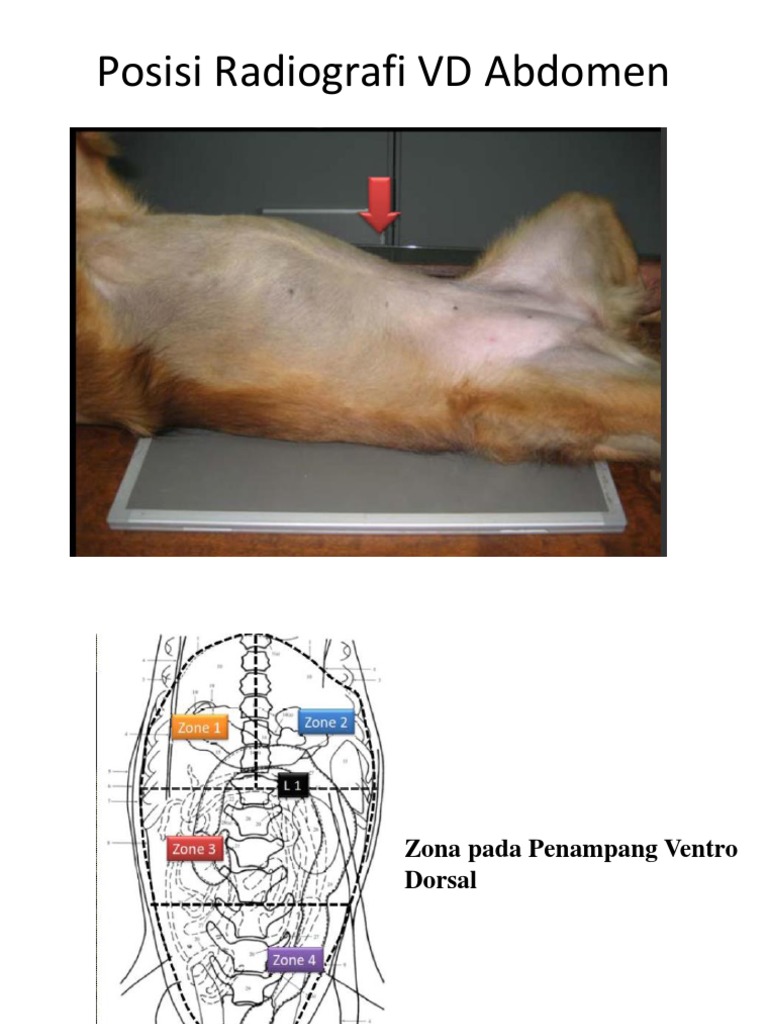 Radiografi VD Abdomen | PDF