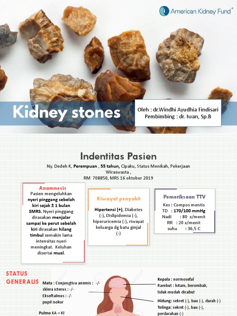 Nephrolithiasis | PDF