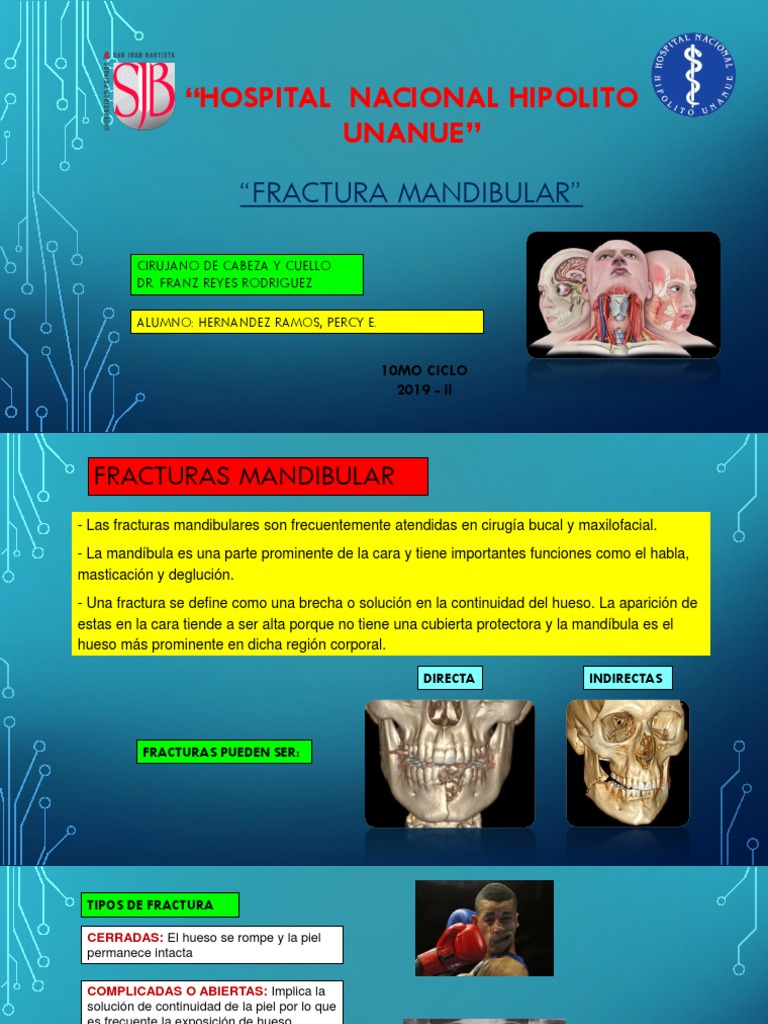 Fracturas mandibulares: clasificación, diagnóstico y tratamiento | PDF ...