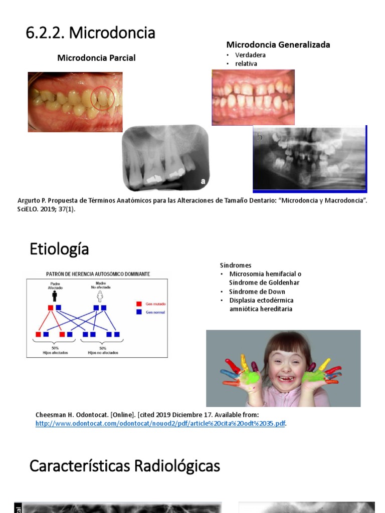 Microdoncia | PDF | Diente | Ciencias de la Salud