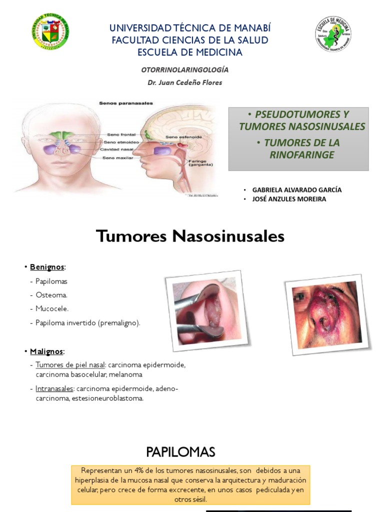 Tumores Nasosinusales y Rinofaringe | PDF | Neoplasias | Cáncer