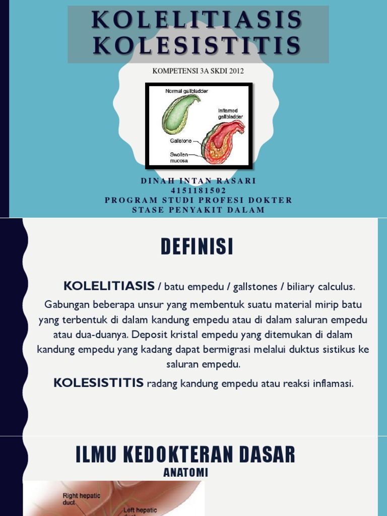 Kolelitiasis Kolesistitis DINAH | PDF | Kesehatan Holistik | Sains ...