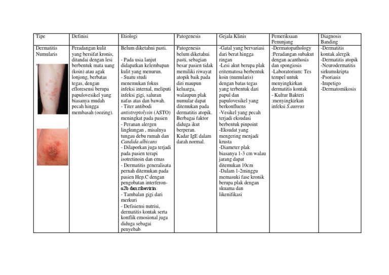 Dermatitis Numularis | PDF