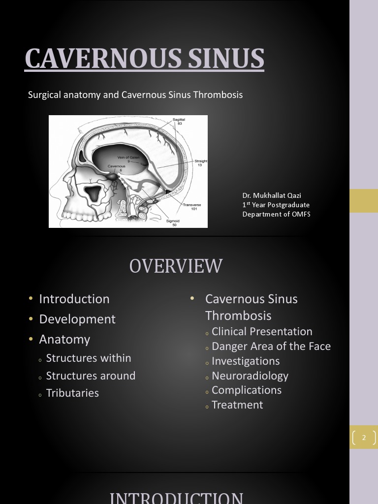 Cavernous Sinus Sagittal