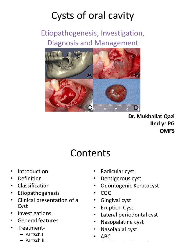 Cysts of Oral Cavity | PDF | Mouth | Animal Anatomy
