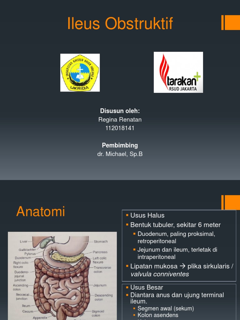 Obstruksi Usus Mekanik 2 | PDF