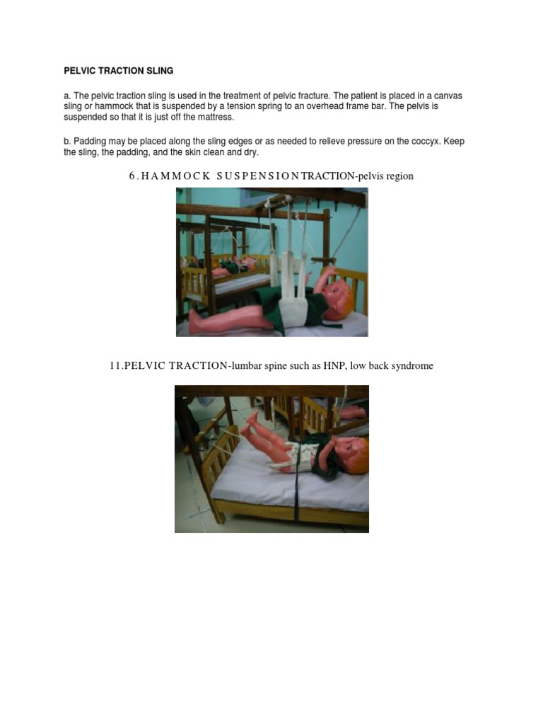 Pelvic Traction Sling | PDF | Pelvis | Constipation