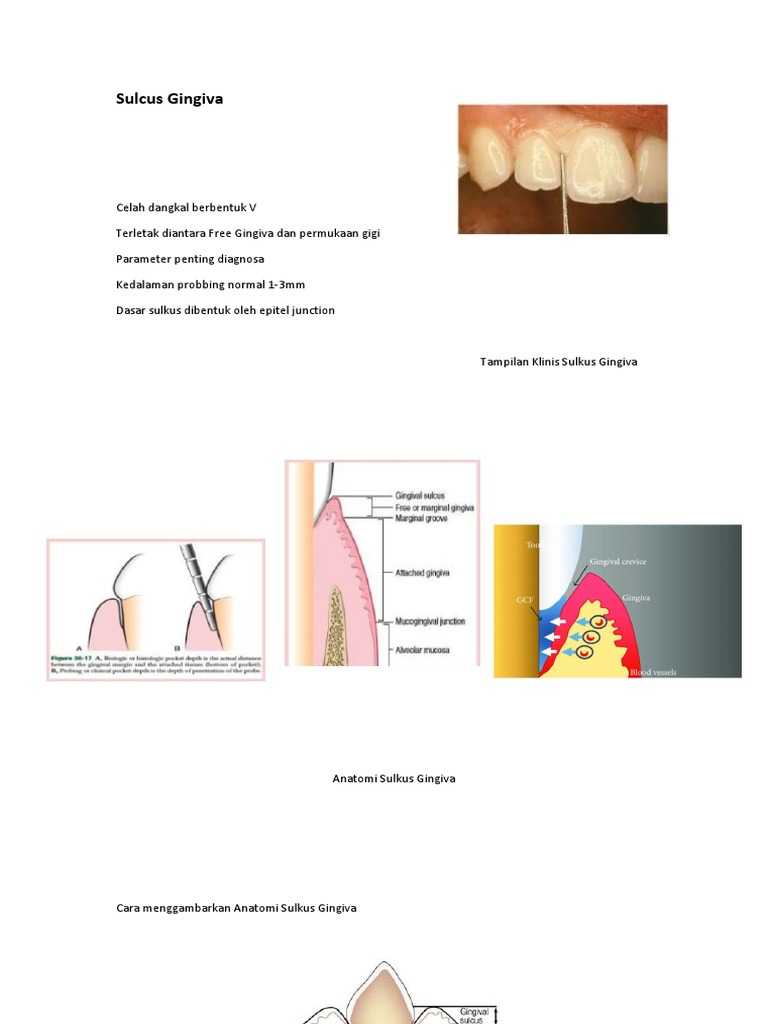 Sulcus Gingiva | PDF