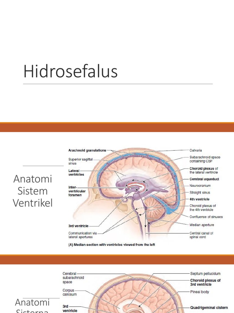 Hidrosefalus | PDF