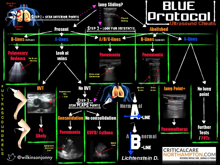 BLUE Protocol 2 | PDF | Lung | Pneumonia