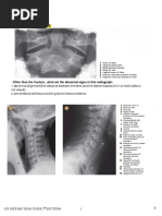 EMRA SportsMedicine Splint Guide | PDF | Thumb | Hand