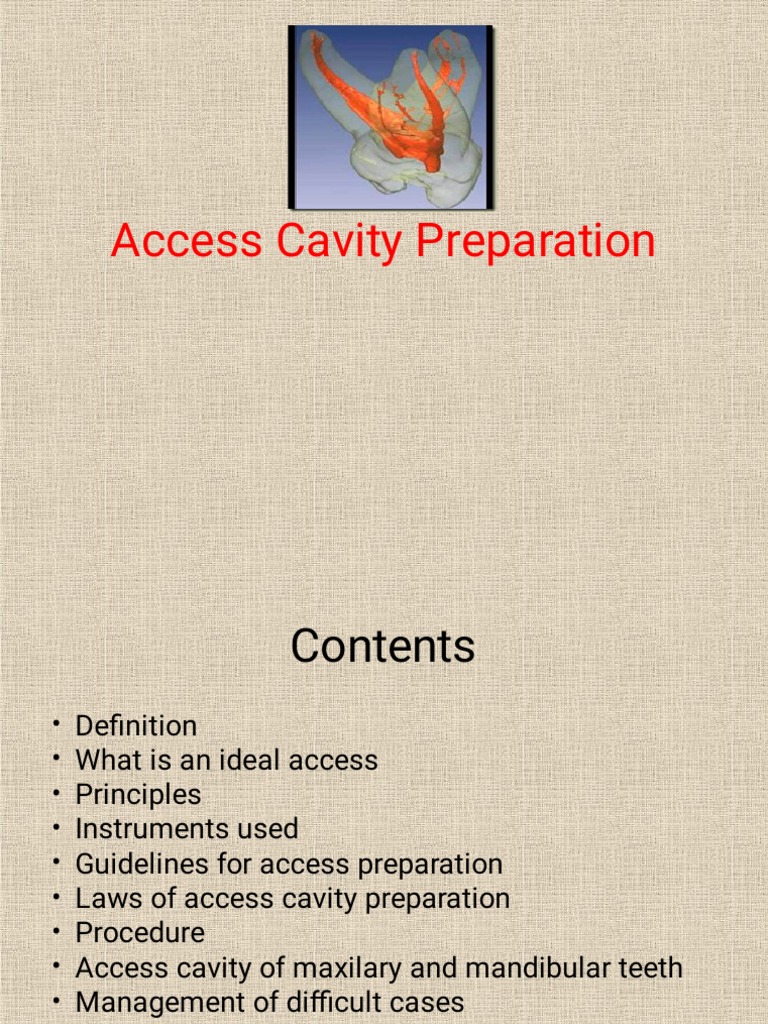 Access Cavity Preparation PDF | PDF | Dental Anatomy | Tooth
