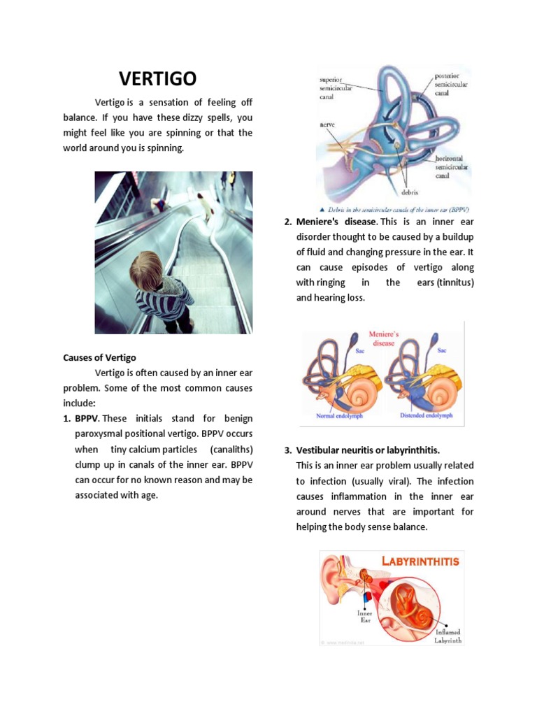 VERTIGO Leaflet | PDF | Vertigo | Ear