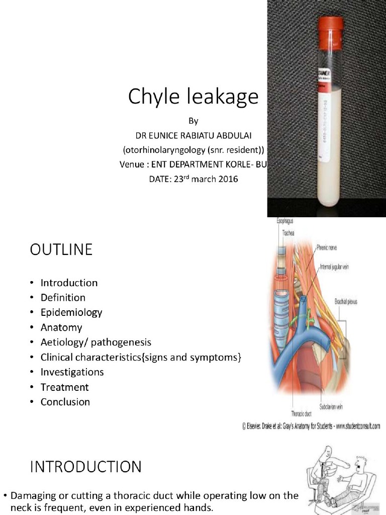 Chyle Leakage | PDF