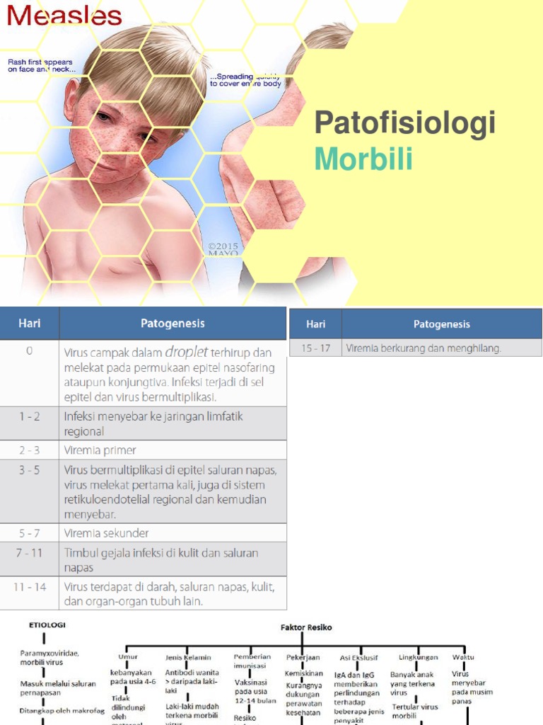 Patofisiologi Morbili | PDF