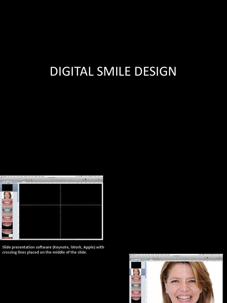 Digital Smile Design Process Overview | PDF | Mouth | Dentistry