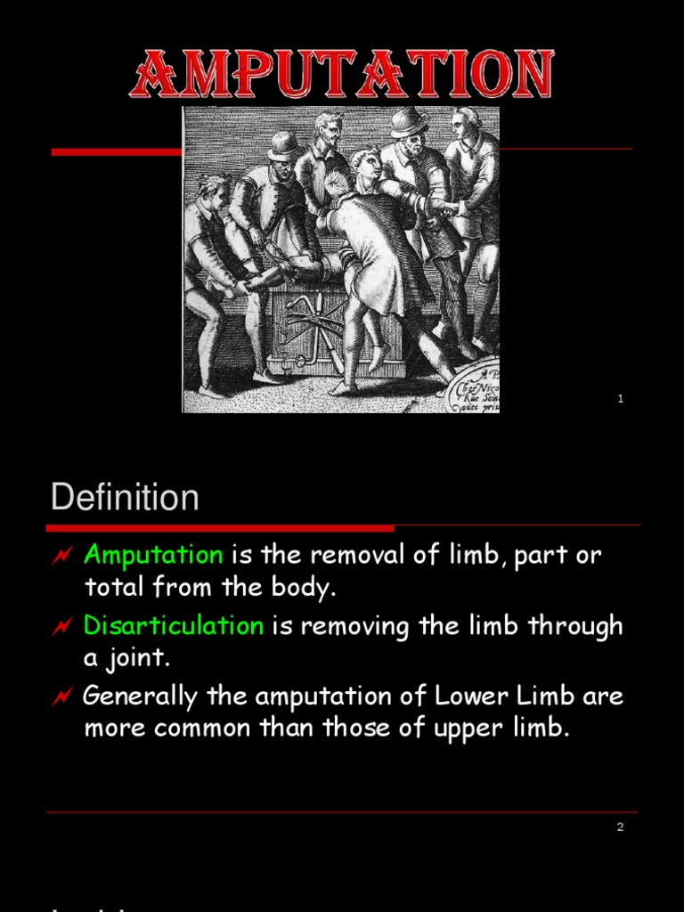 Amputations | Download Free PDF | Amputation | Prosthesis