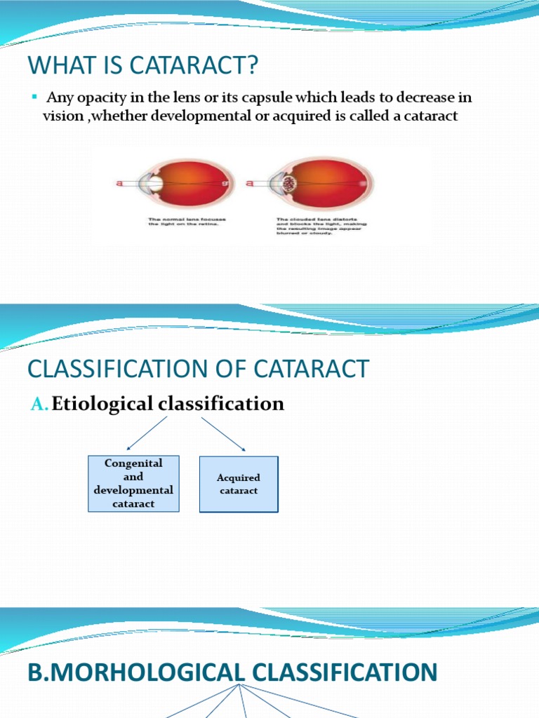 Cataract | PDF | Cataract | Human Eye