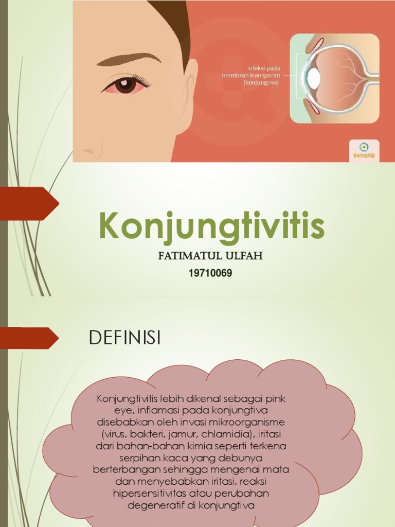 Konjungtivitis: Inflamasi Konjungtiva Yang Disebabkan Oleh Berbagai ...