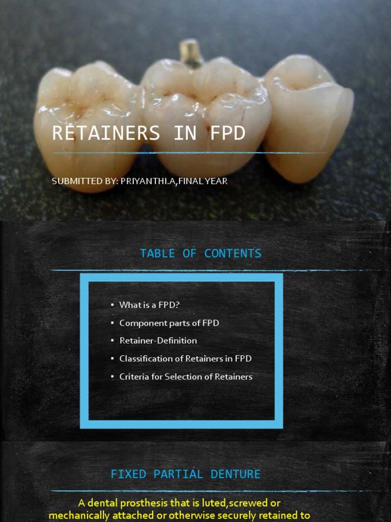 Classification of Retainers in FPD | PDF | Mouth | Dentistry