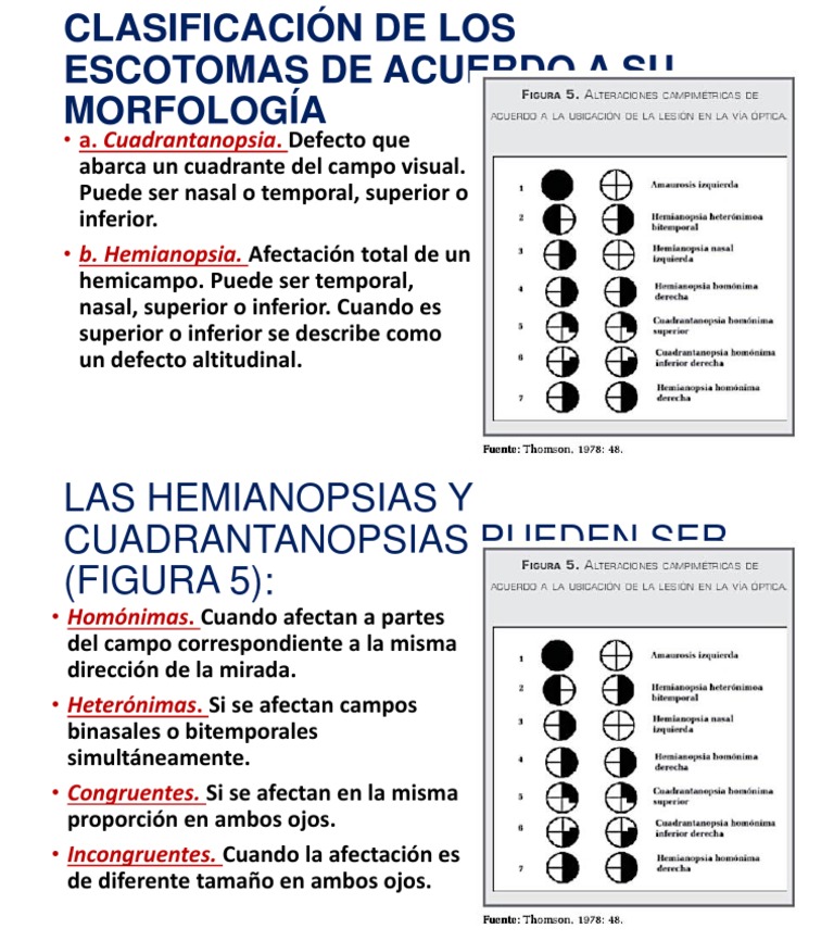 clasificacion escotomas