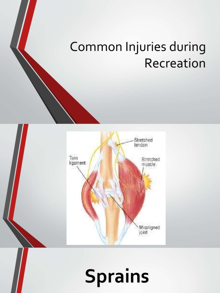 Common Injuries in Recreation | PDF | Knee | Musculoskeletal Disorders Common Injuries in Recreation | PDF | Knee | Musculoskeletal Disorders