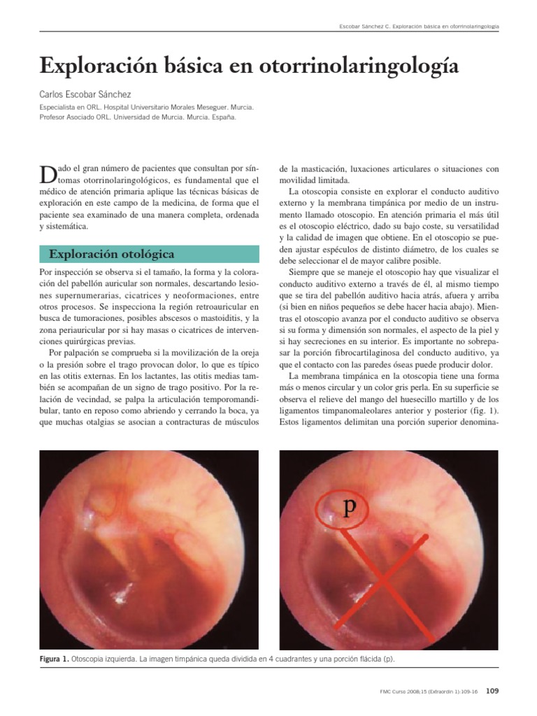Exploracion Basica en Orl | Descargar gratis PDF | Cabeza y cuello humanos | Anatomía humana