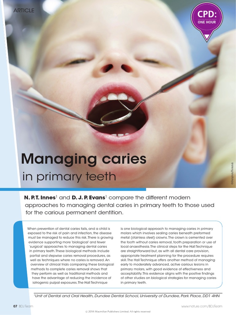 BDJ Team - Managing Caries in Primary Teeth | PDF | Human Tooth | Dentistry
