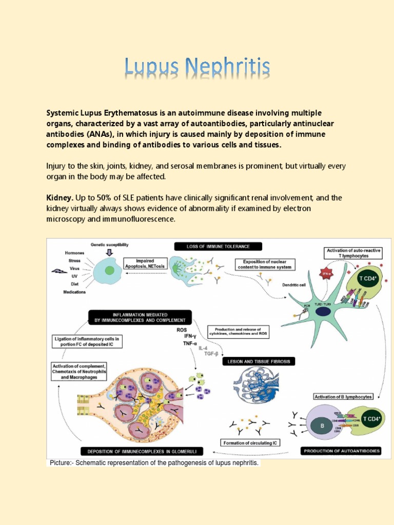 Lupus Nephritis: Types and Pathogenesis | PDF | Systemic Lupus ...