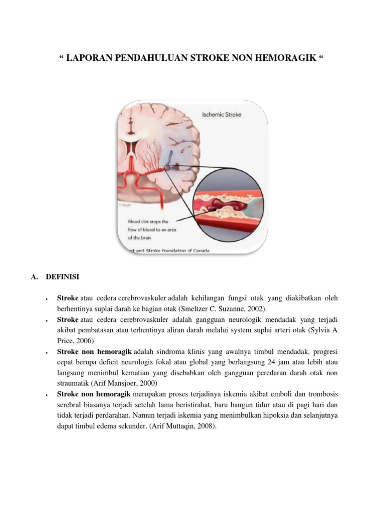 Seminar Stroke Non Hemoragic | PDF