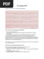 Paul Varosy - ECG Criteria For Distinguishing SVT From VT | PDF ...