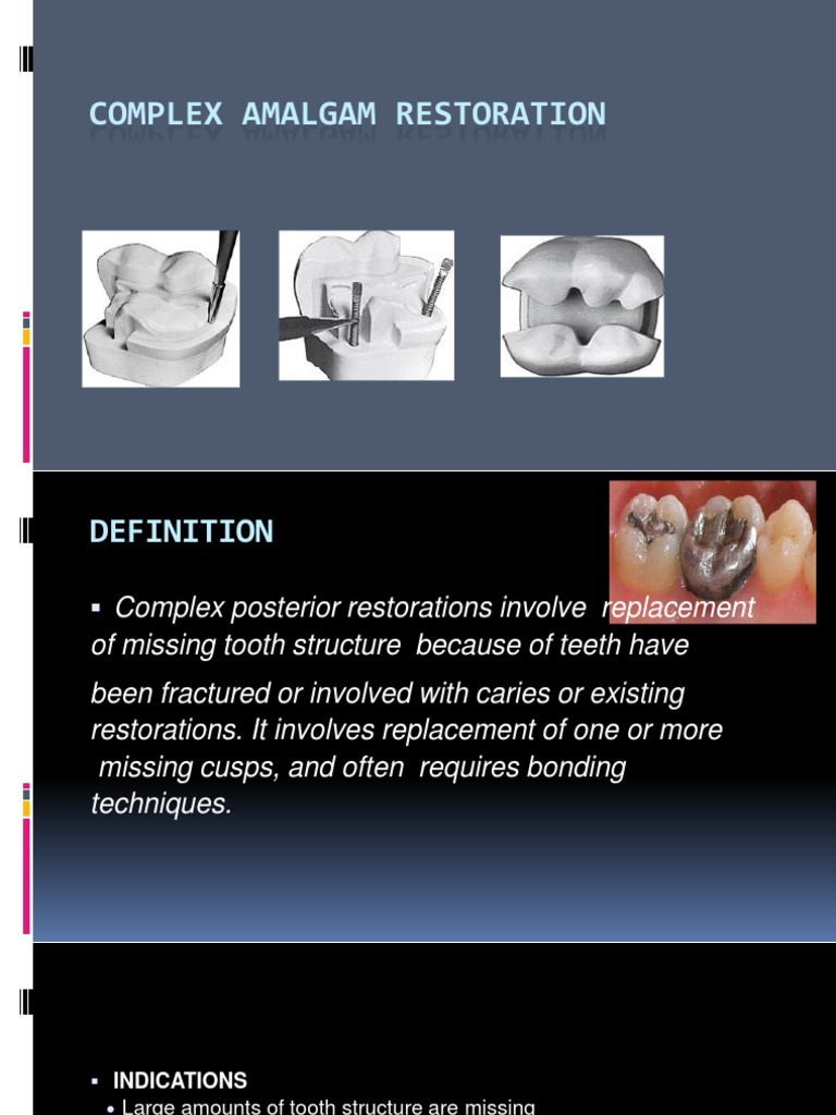 Complex Amalgam Restoration Lecture | PDF | Human Tooth | Mouth