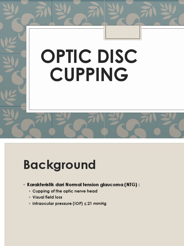 Optic Disc Cupping | PDF | Glaucoma | Senses