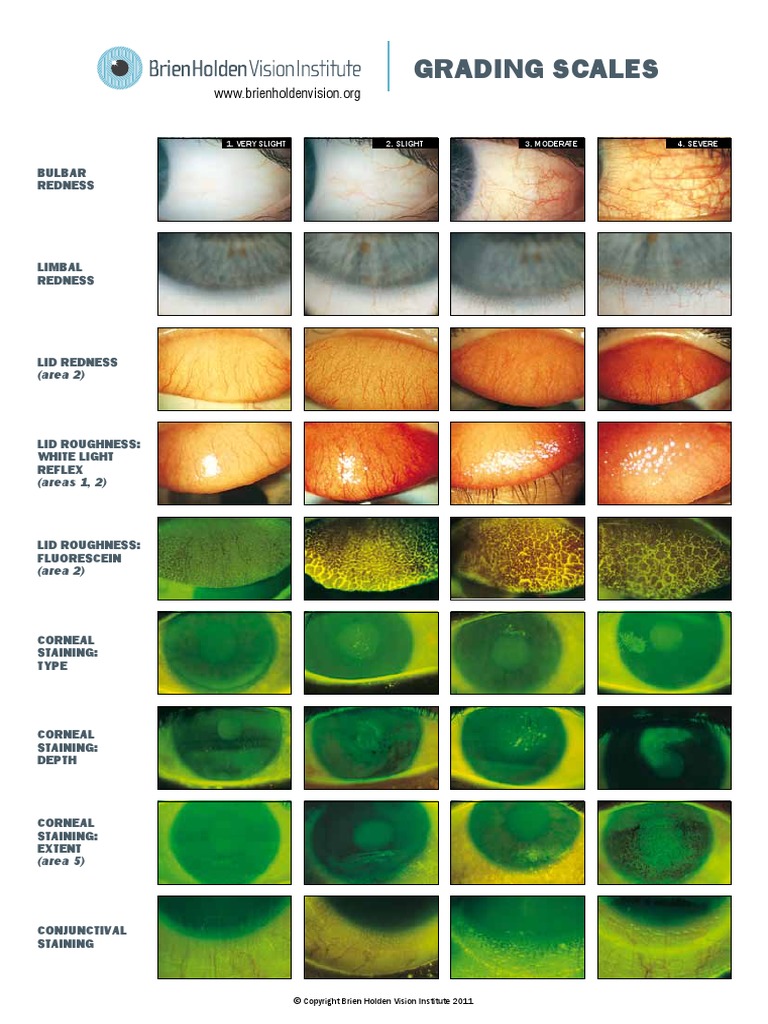 Grading Scales Web PDF | PDF | Cornea | Contact Lens