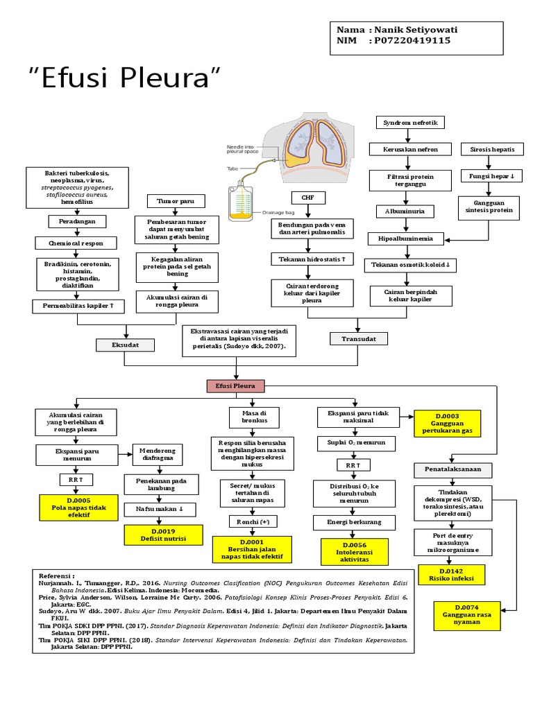 Woc Efusi Pleura-1 | PDF
