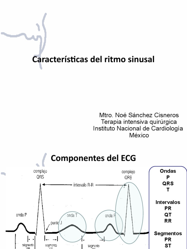 Características Del Ritmo Sinusal - PPSX | PDF | Electrocardiografia ...