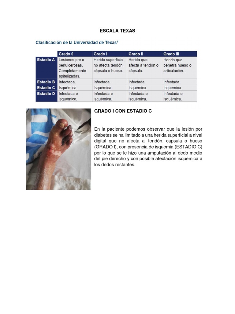 Escala Texas | PDF