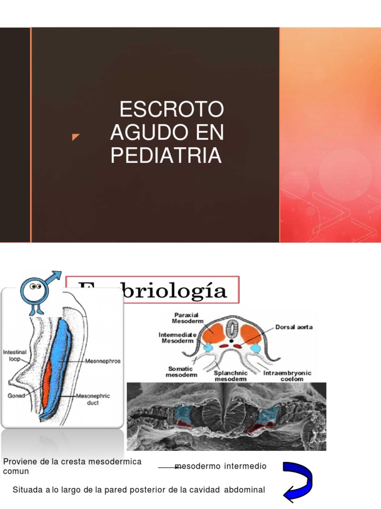 Escroto Agudo en Pediatría | PDF | Testículo | Abdomen