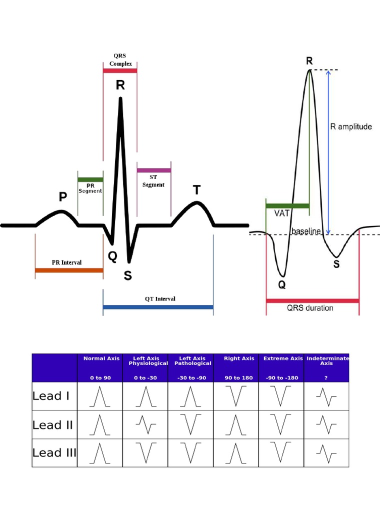 Gelombang EKG