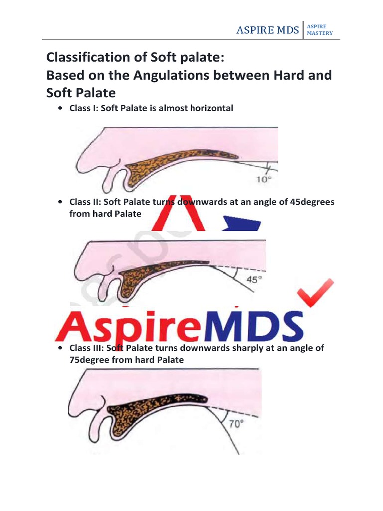 Aspire MDS - Soft Palate Classification | PDF