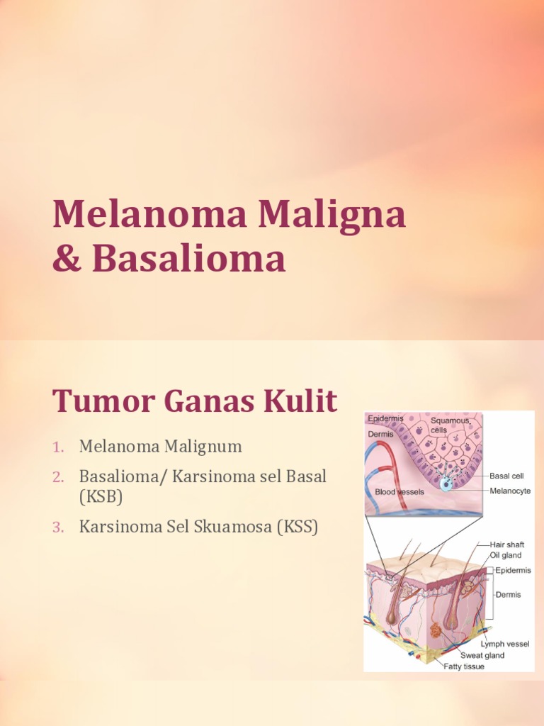 Melanoma Maligna & Basalioma | PDF