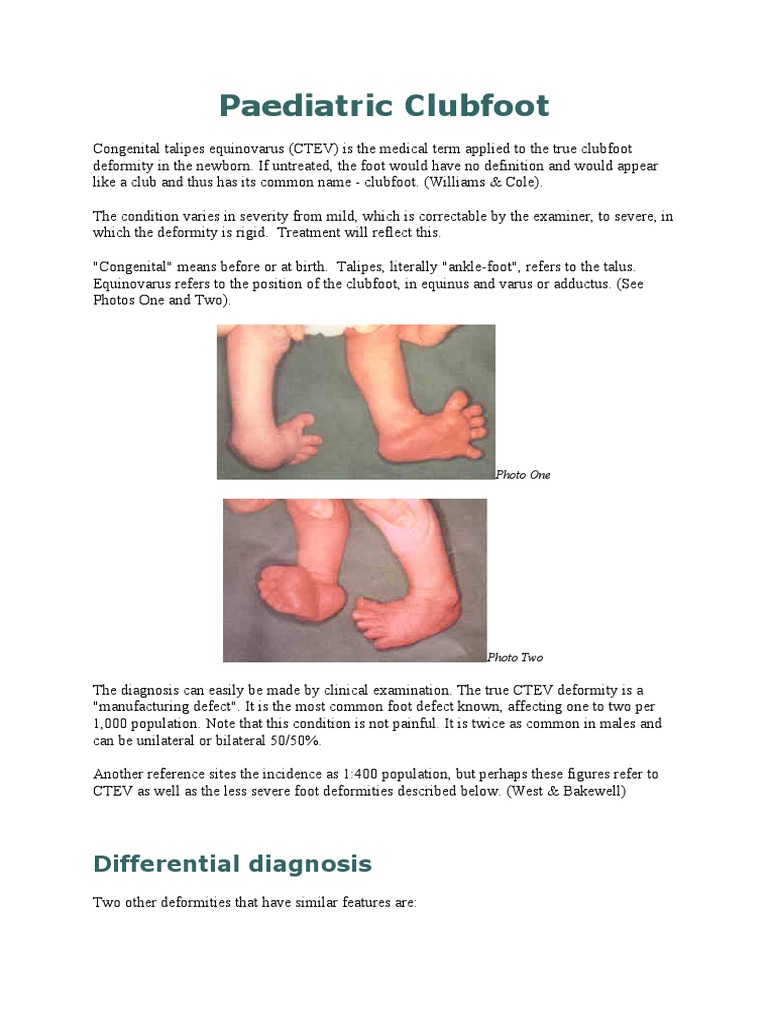 Paediatric Clubfoot: Differential Diagnosis | Download Free PDF | Foot ...