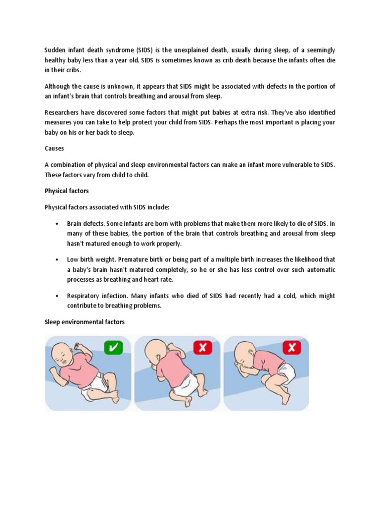 SIDS: Reduce Risks With Back Sleeping | PDF | Diseases And Disorders ...