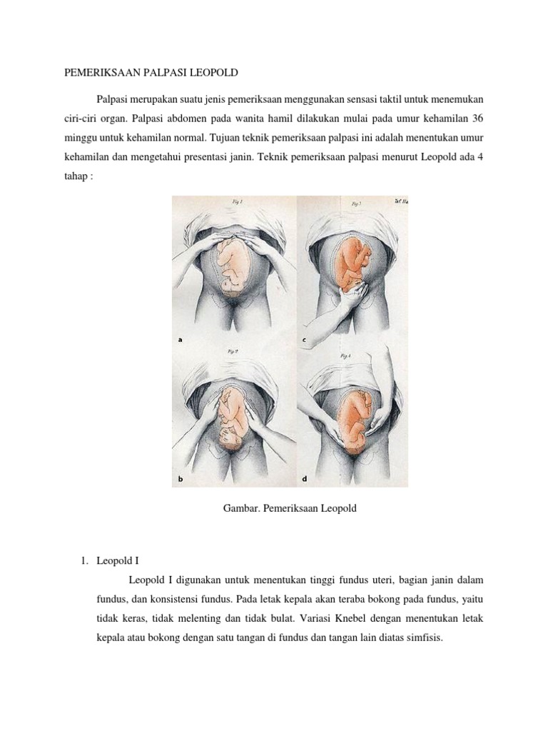 Pemeriksaan Palpasi Leopold | PDF
