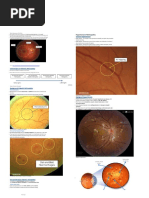 Tangent Screen Visual Field Testing | PDF | Retina | Color
