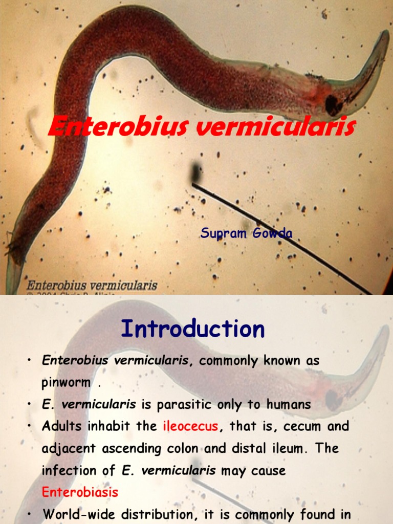 Enterobius Vermicularis
