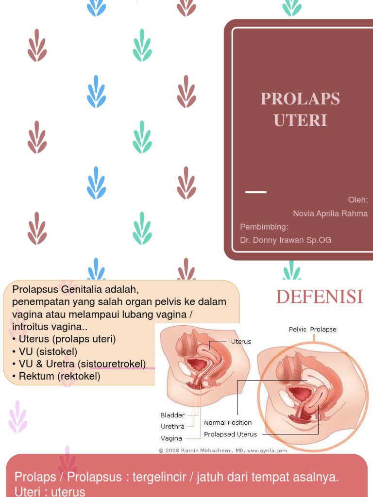 PROLAPSUS-UTERI Opi | PDF