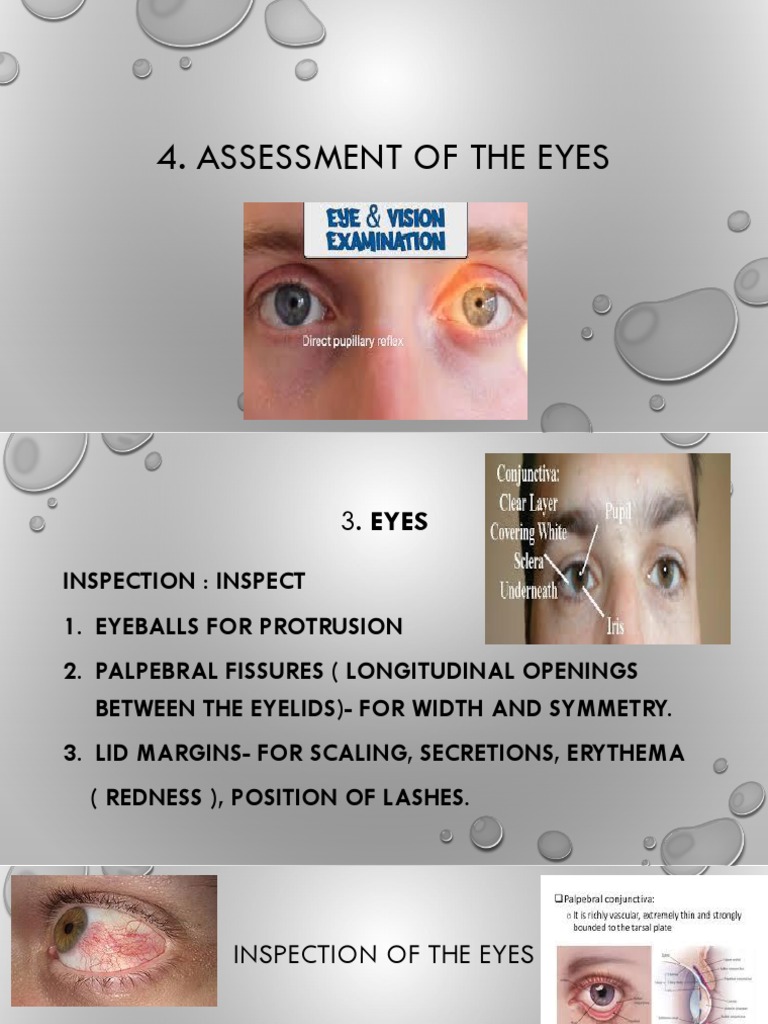 Eyes Assessment | PDF | Human Eye | Visual Acuity